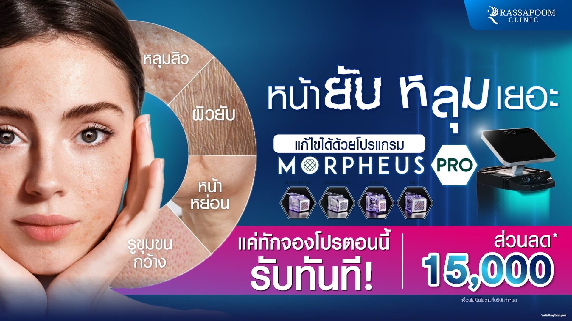 โปรแกรม Morpheus Pro - Rassapoom Clinic